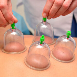 Cupping Therapy Side Effects: Risks and Precautions