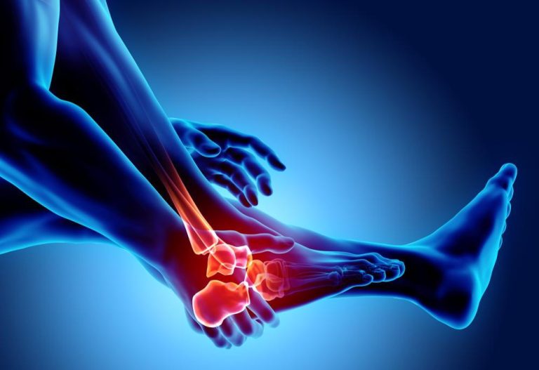 What Causes Arthritis? Key Triggers Explained