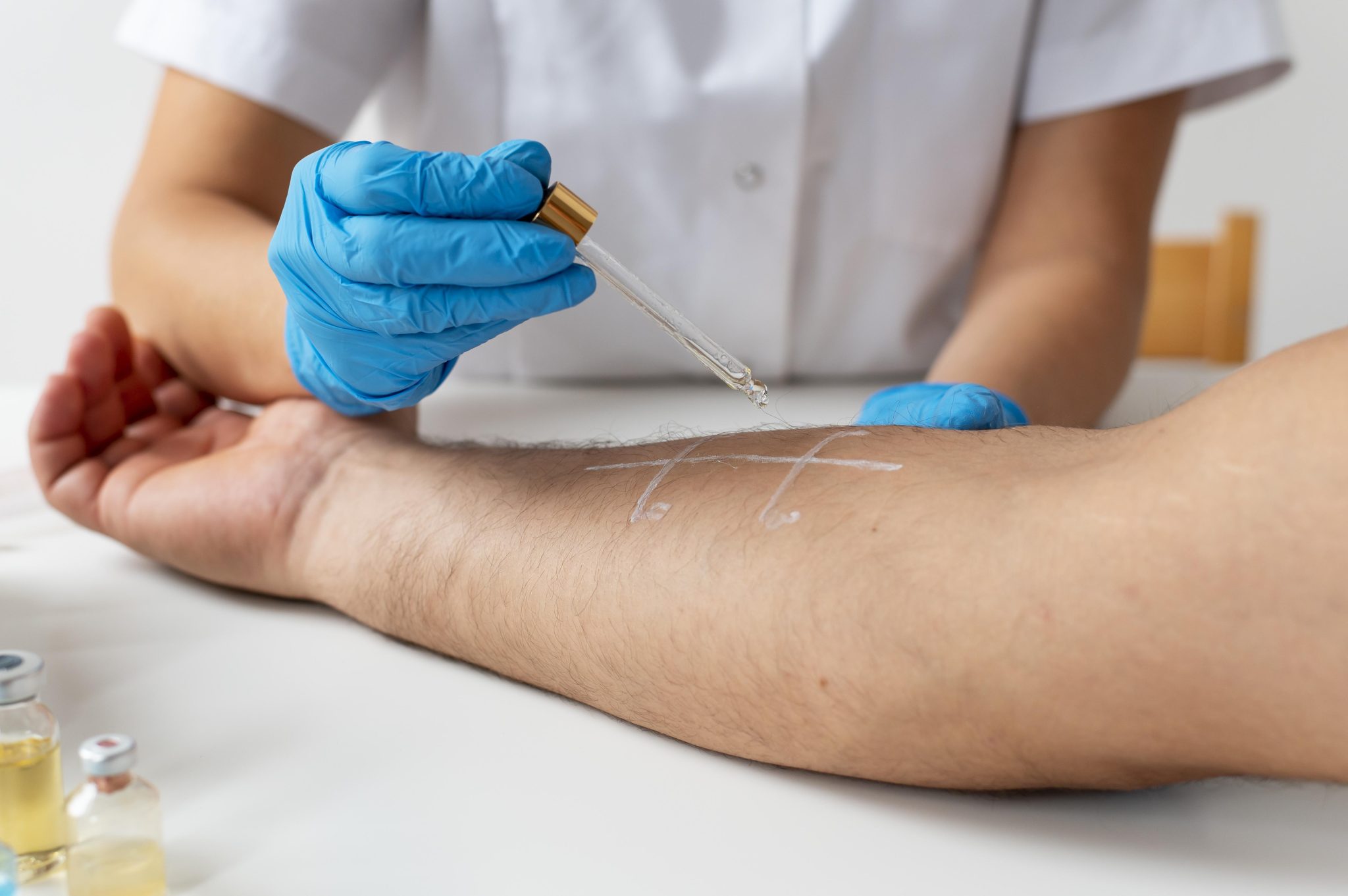 How Effective Is Dry Needling for Tennis Elbow | Benefits & Results